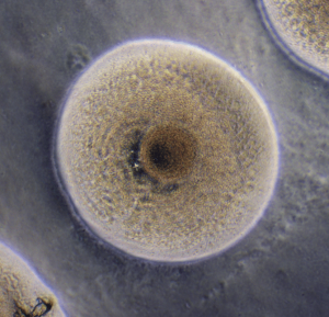 Programa Nacional Voluntario De Vigilancia, Control Y Erradicación De ...